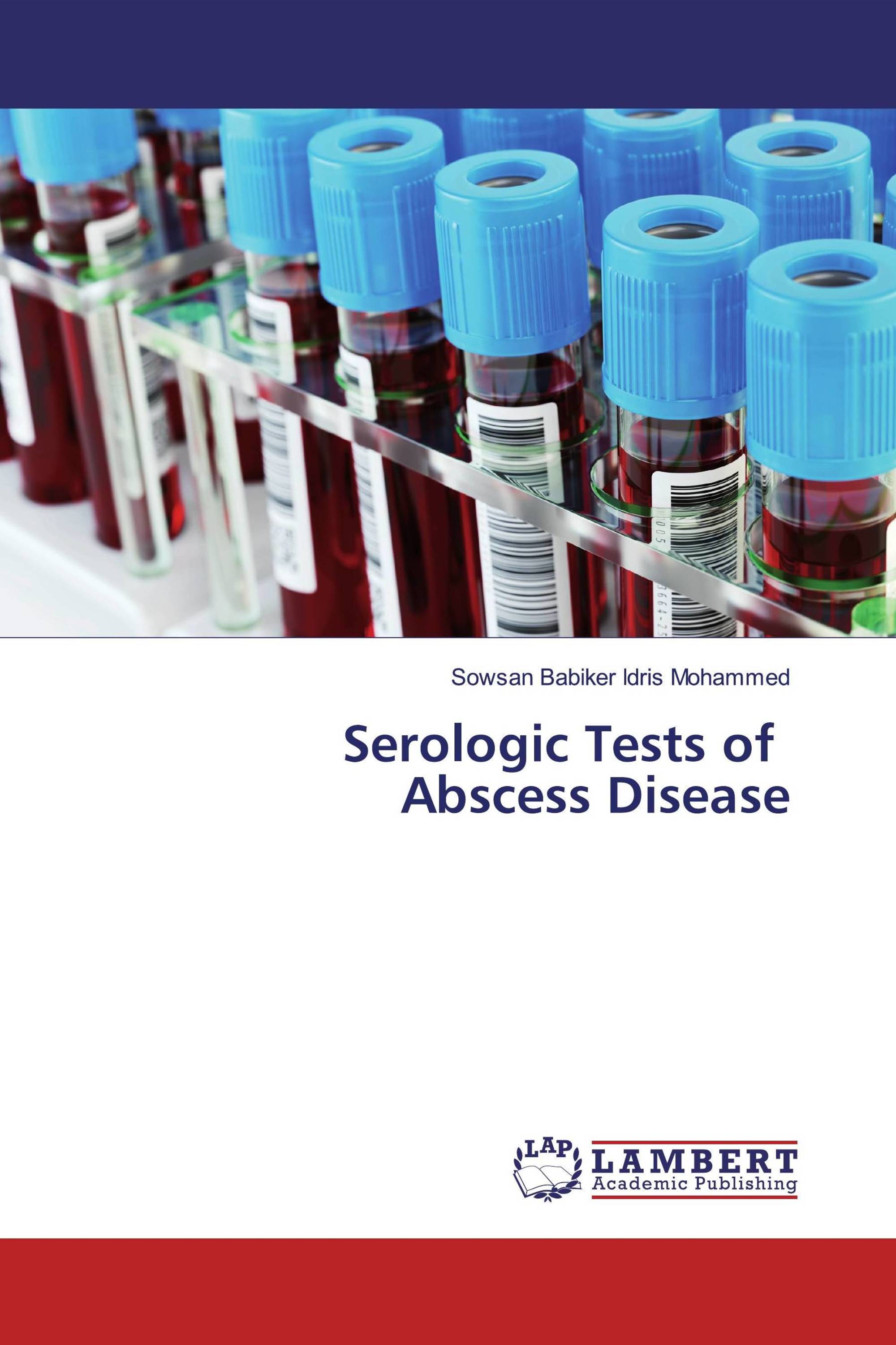 Nursing Mcq39s And Guide Serological Tests