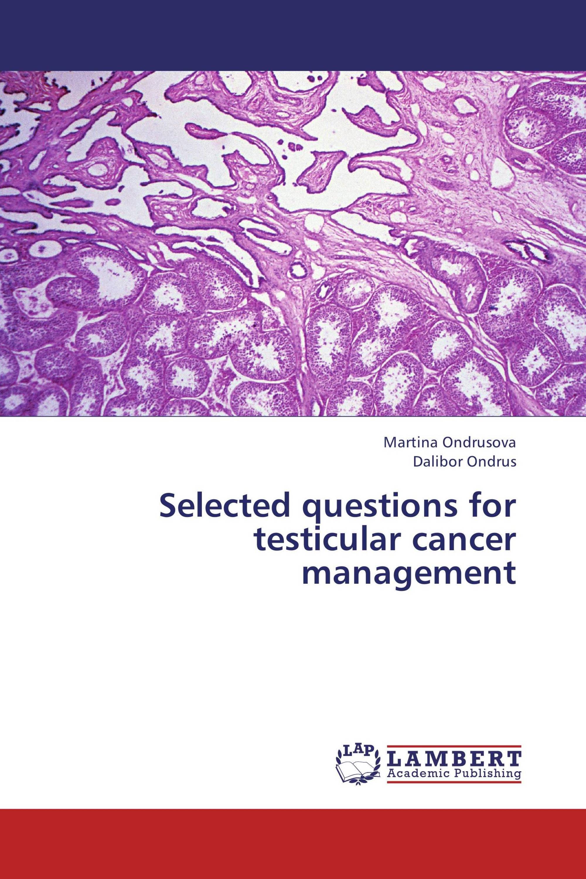 Selected questions for testicular cancer management / 978-3-659-41288-2 ...