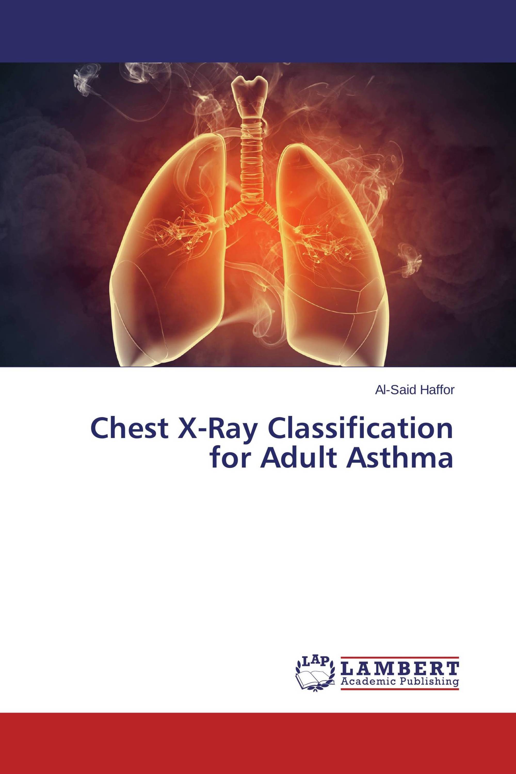 Chest X Ray Classification For Adult Asthma 978 3 659 56374 4 9783659563744 3659563749