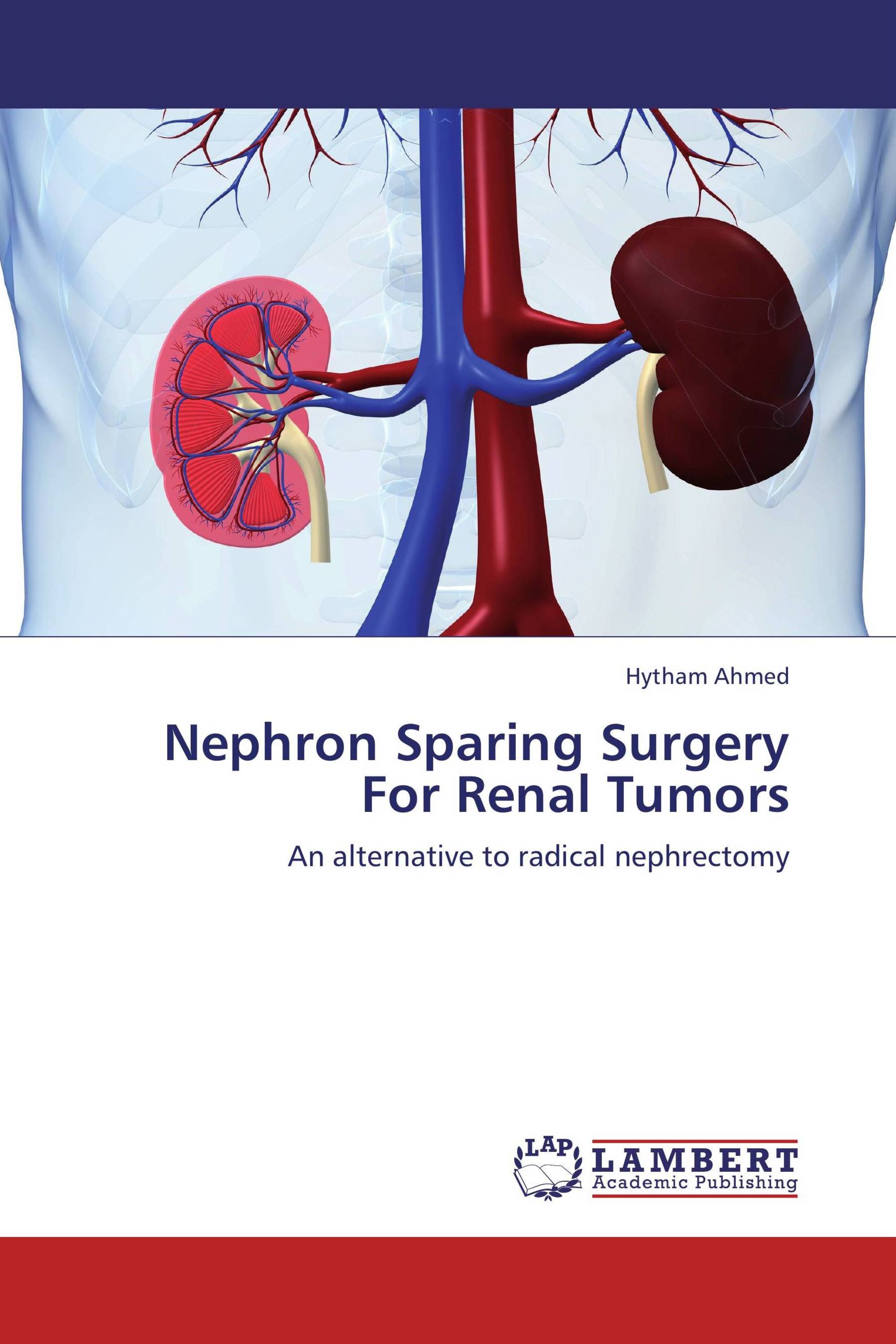 Nephron Sparing Surgery For Renal Tumors / 978-3-8484-8193-4 ...