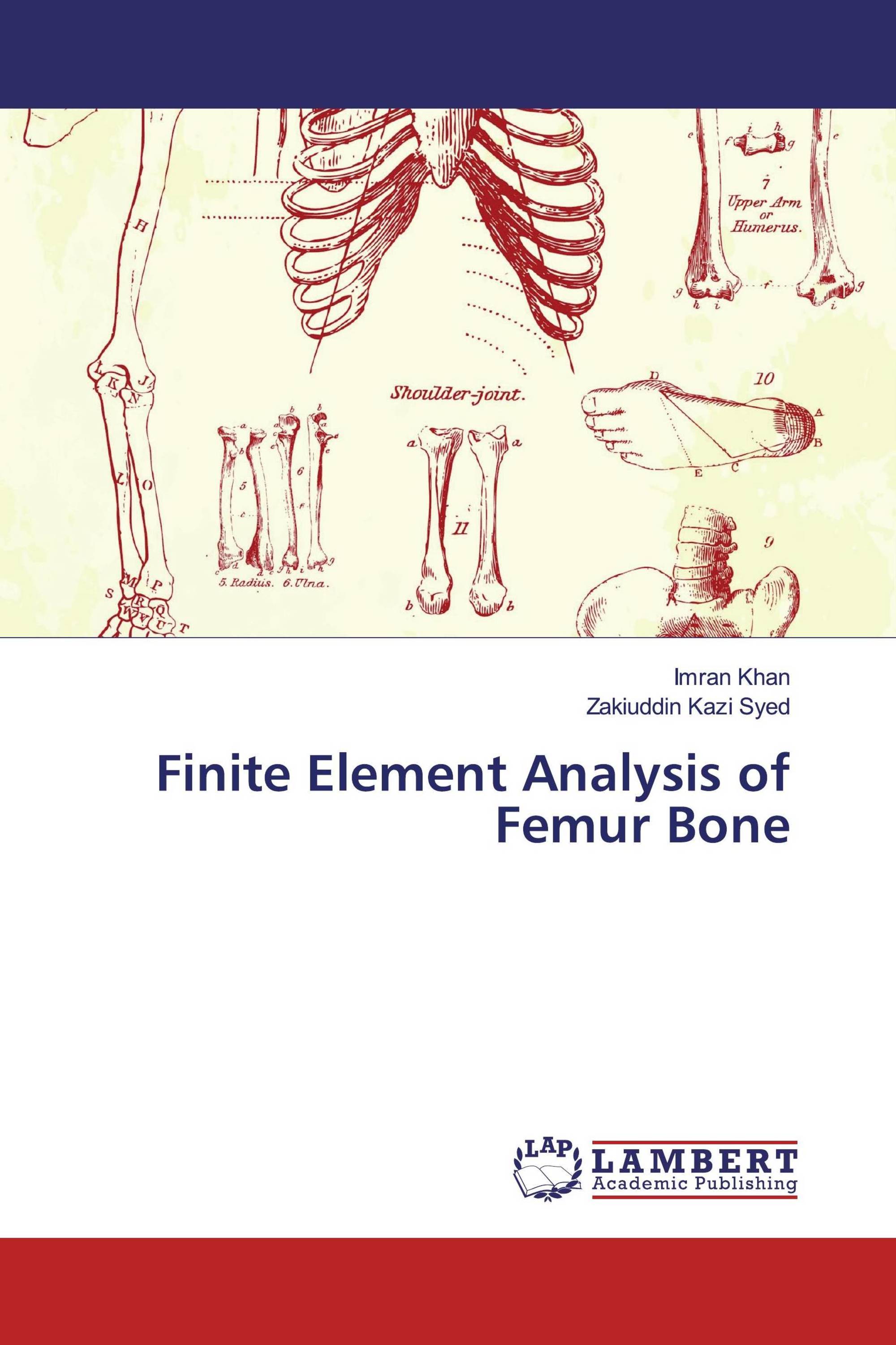 Finite Element Analysis Of Femur Bone 978 613 9 93067 8