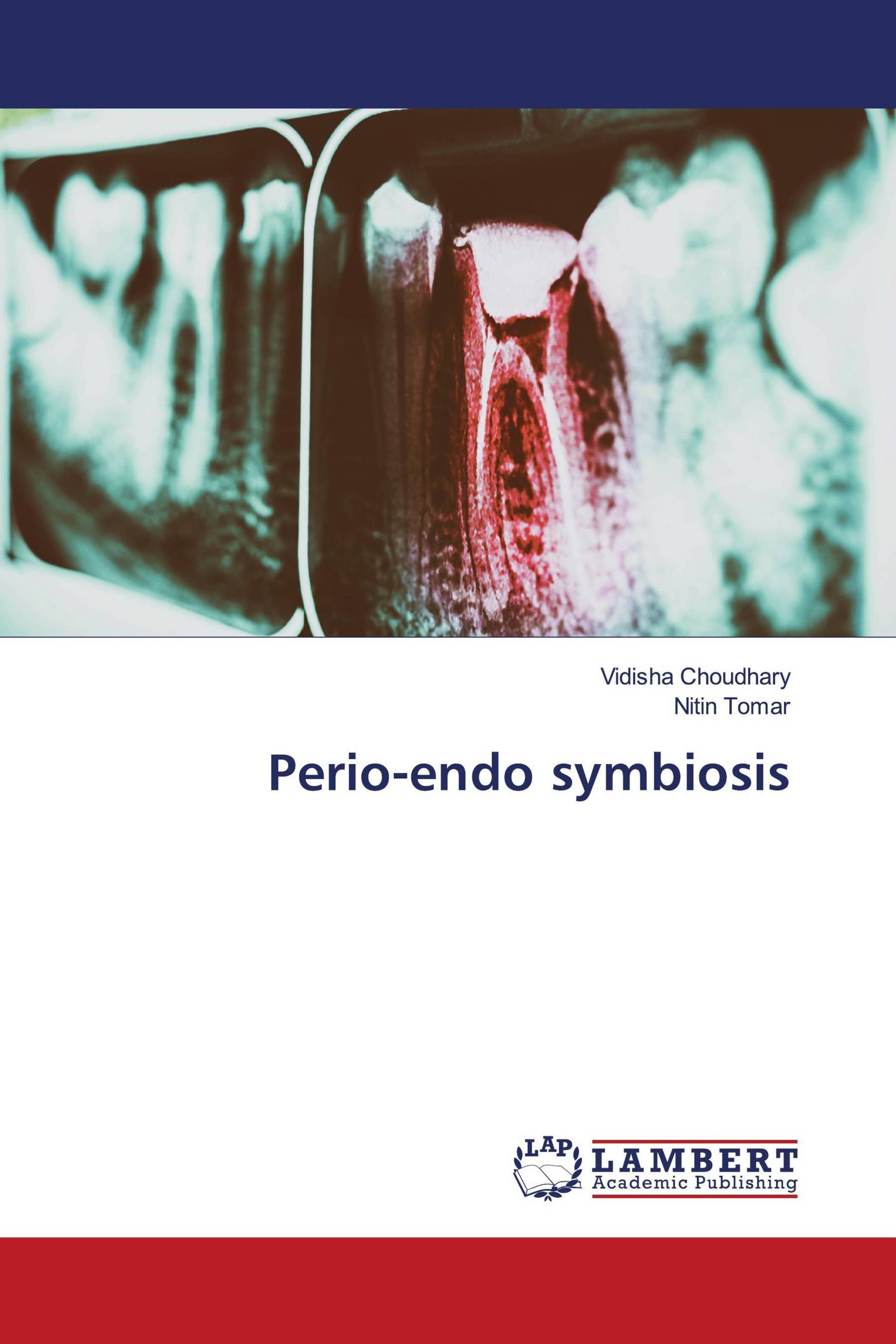 Perio-endo symbiosis / 978-620-3-85574-6 / 9786203855746 / 620385574X