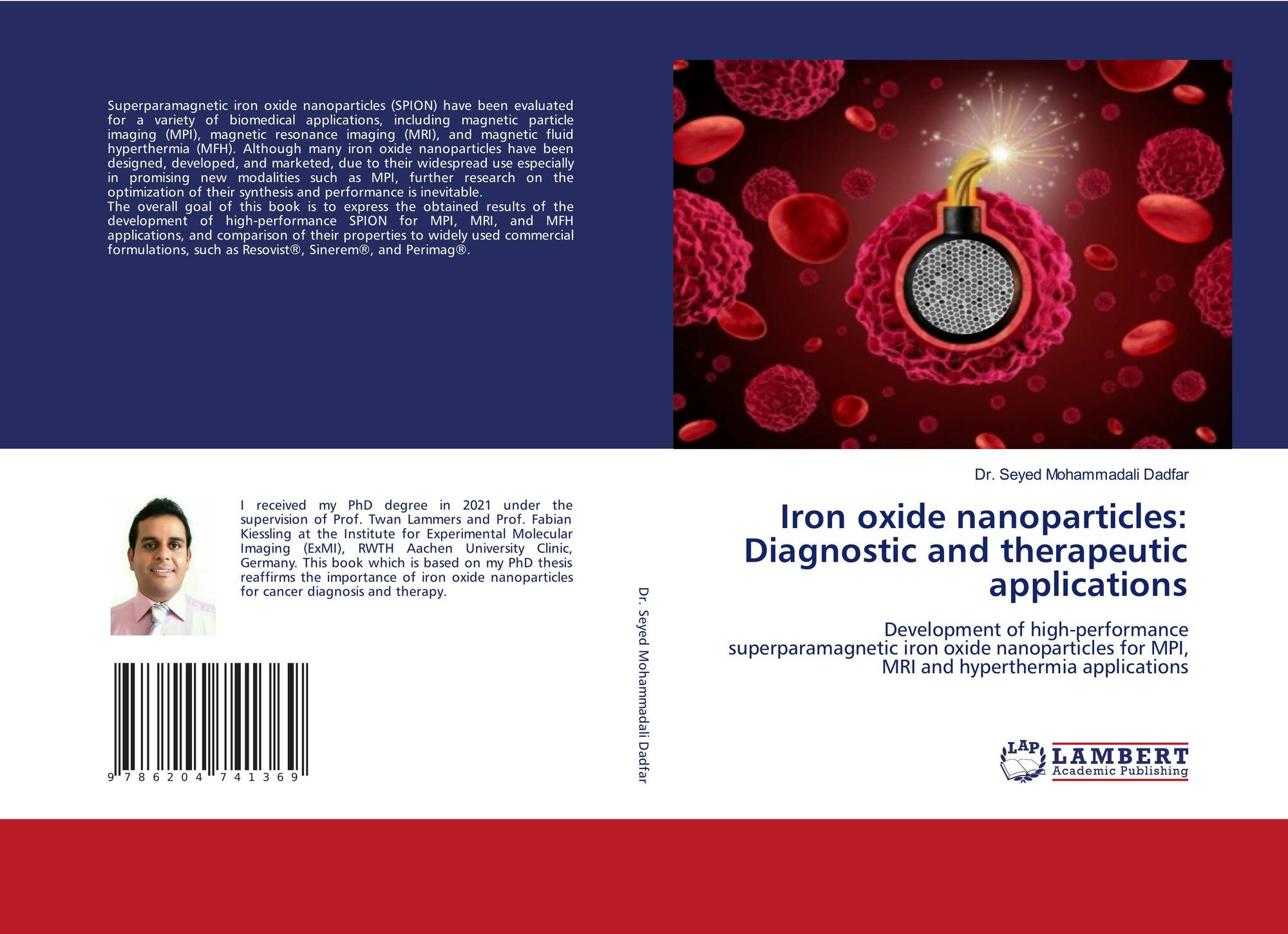 Iron oxide nanoparticles: Diagnostic and therapeutic applications Iron oxide nanoparticles: Diagnostic and therapeutic applications