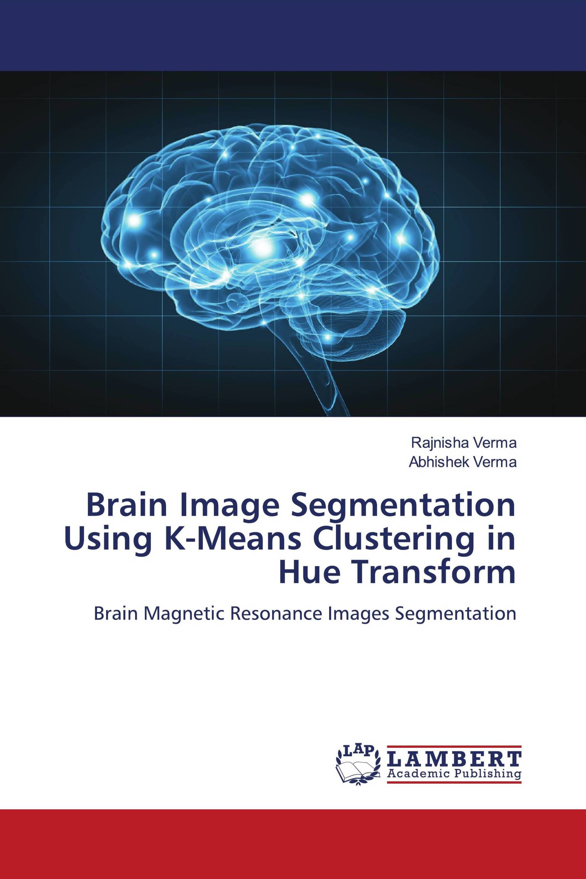 Brain Image Segmentation Using K Means Clustering In Hue Transform 978 620 6 15625 3