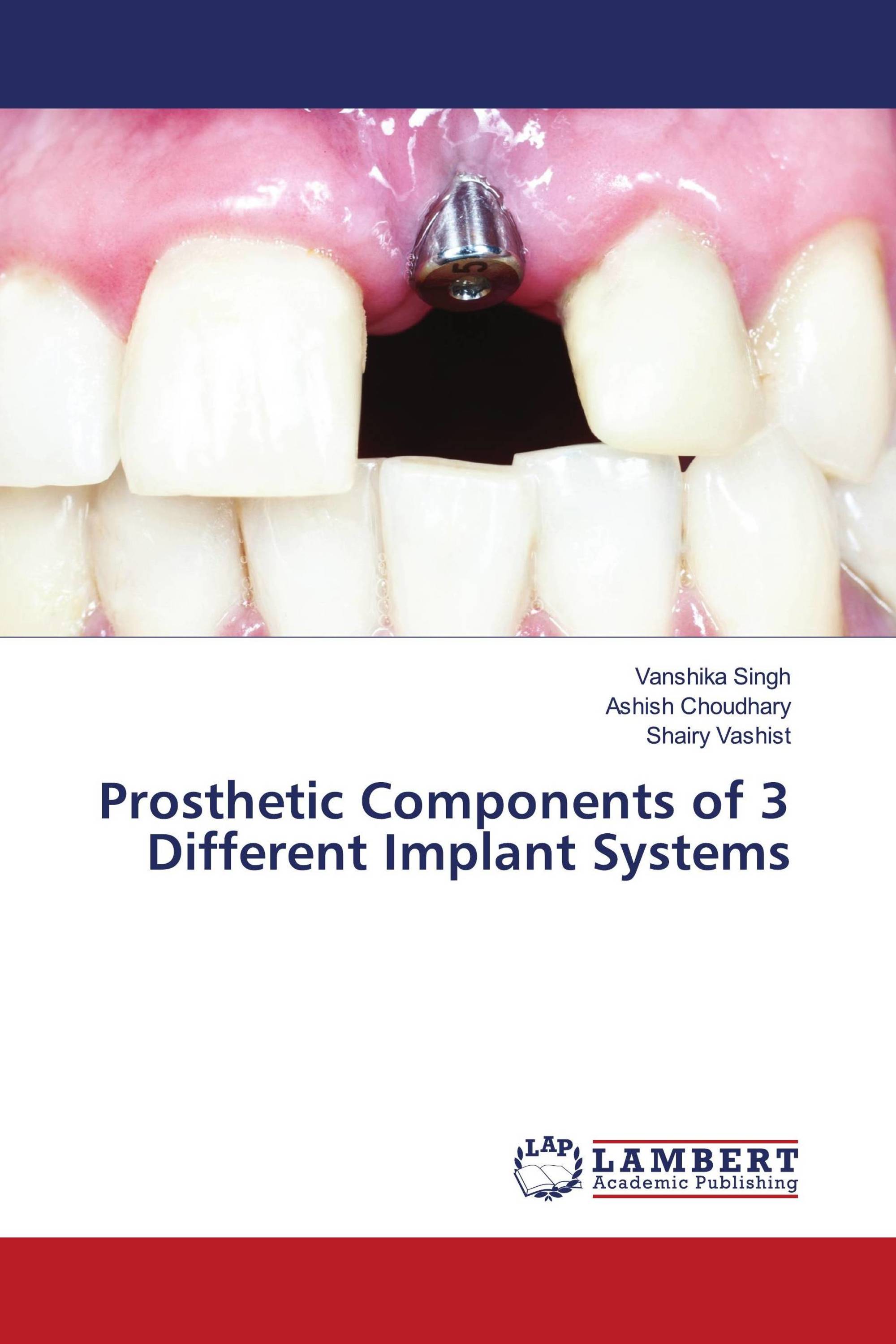 Prosthetic Components of 3 Different Implant Systems / 978-620-6-18207 ...