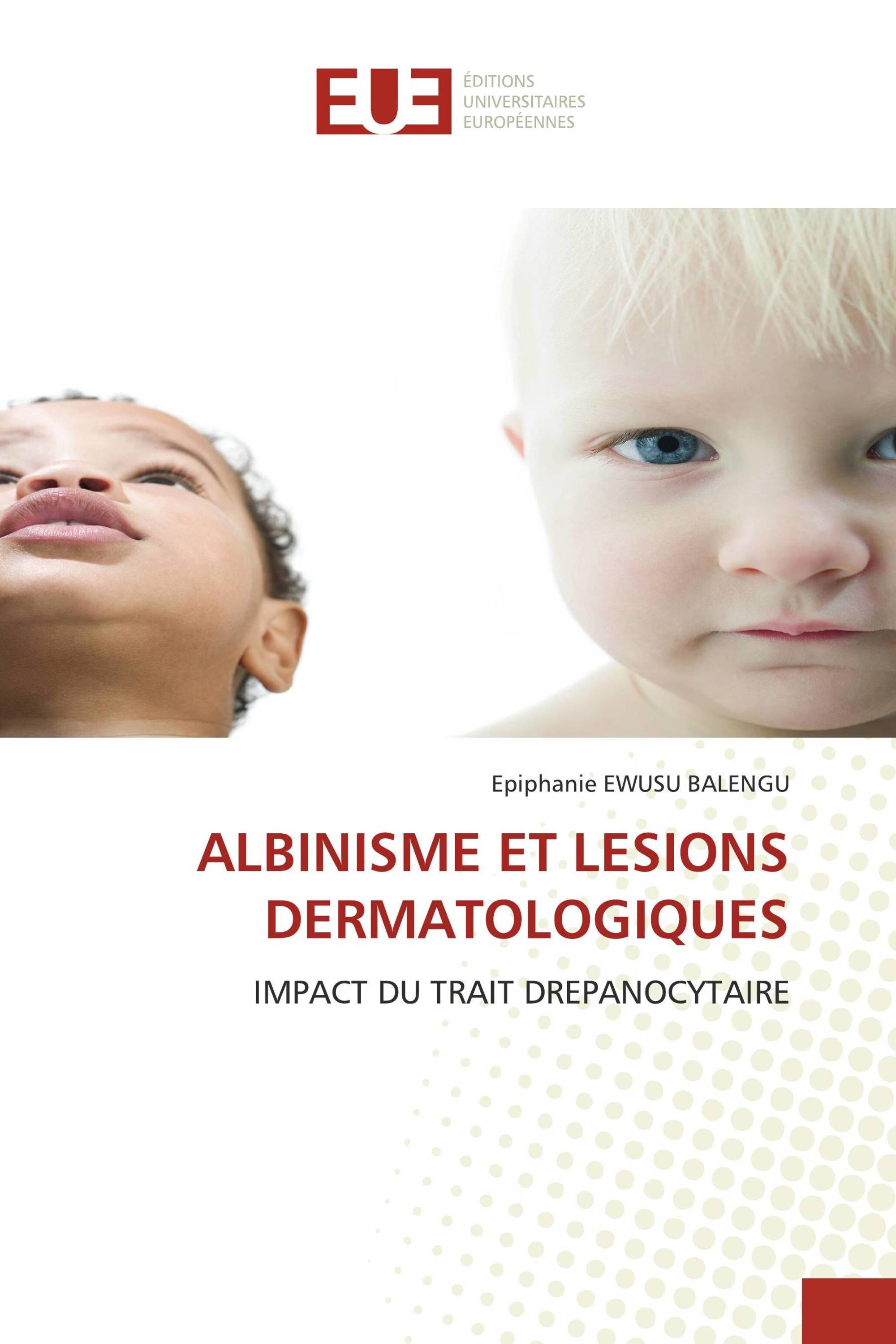 ALBINISME ET LESIONS DERMATOLOGIQUES
