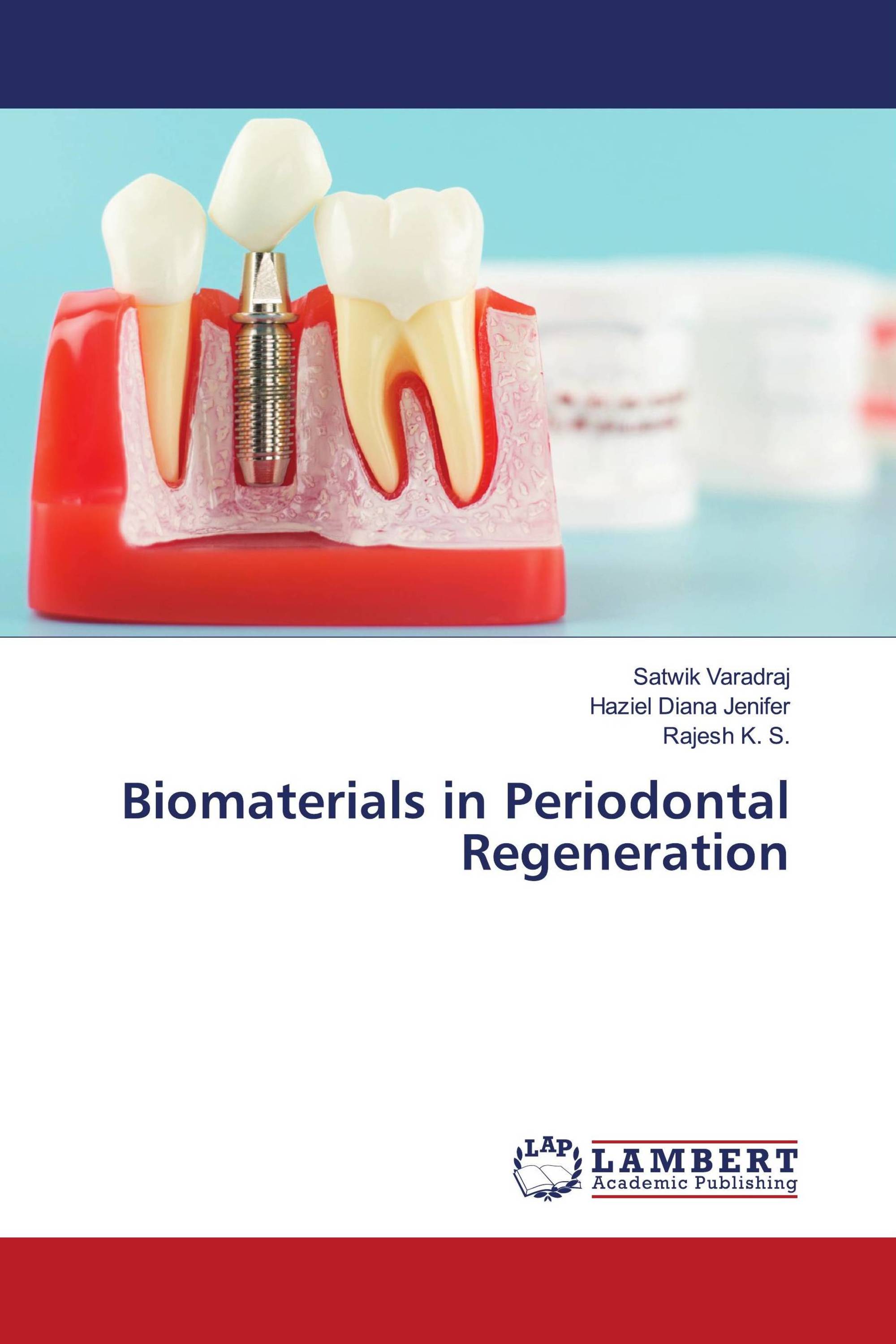 Biomaterials in Periodontal Regeneration / 978-620-7-47116-4 ...