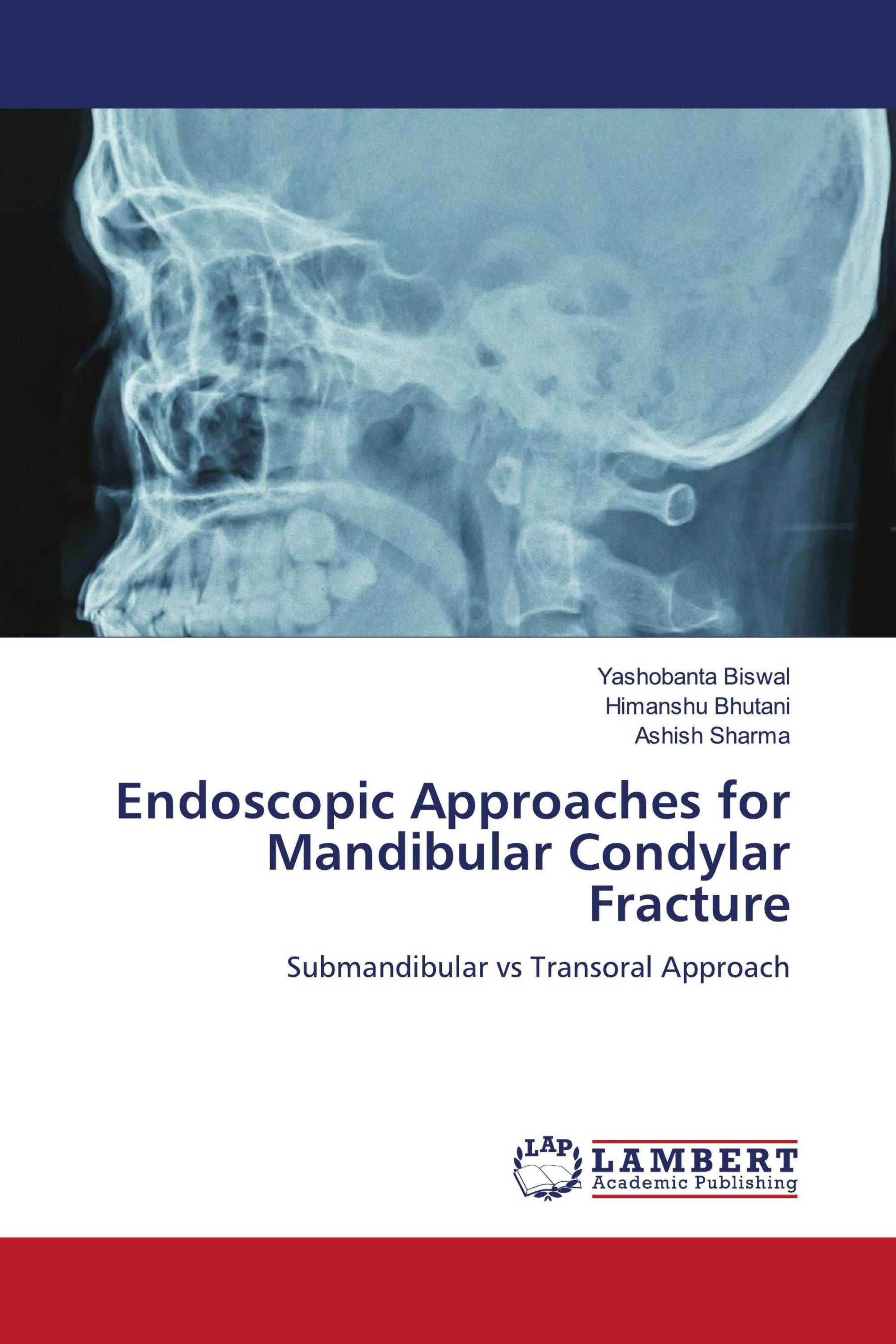 Endoscopic Approaches for Mandibular Condylar Fracture / 978-620-7 ...