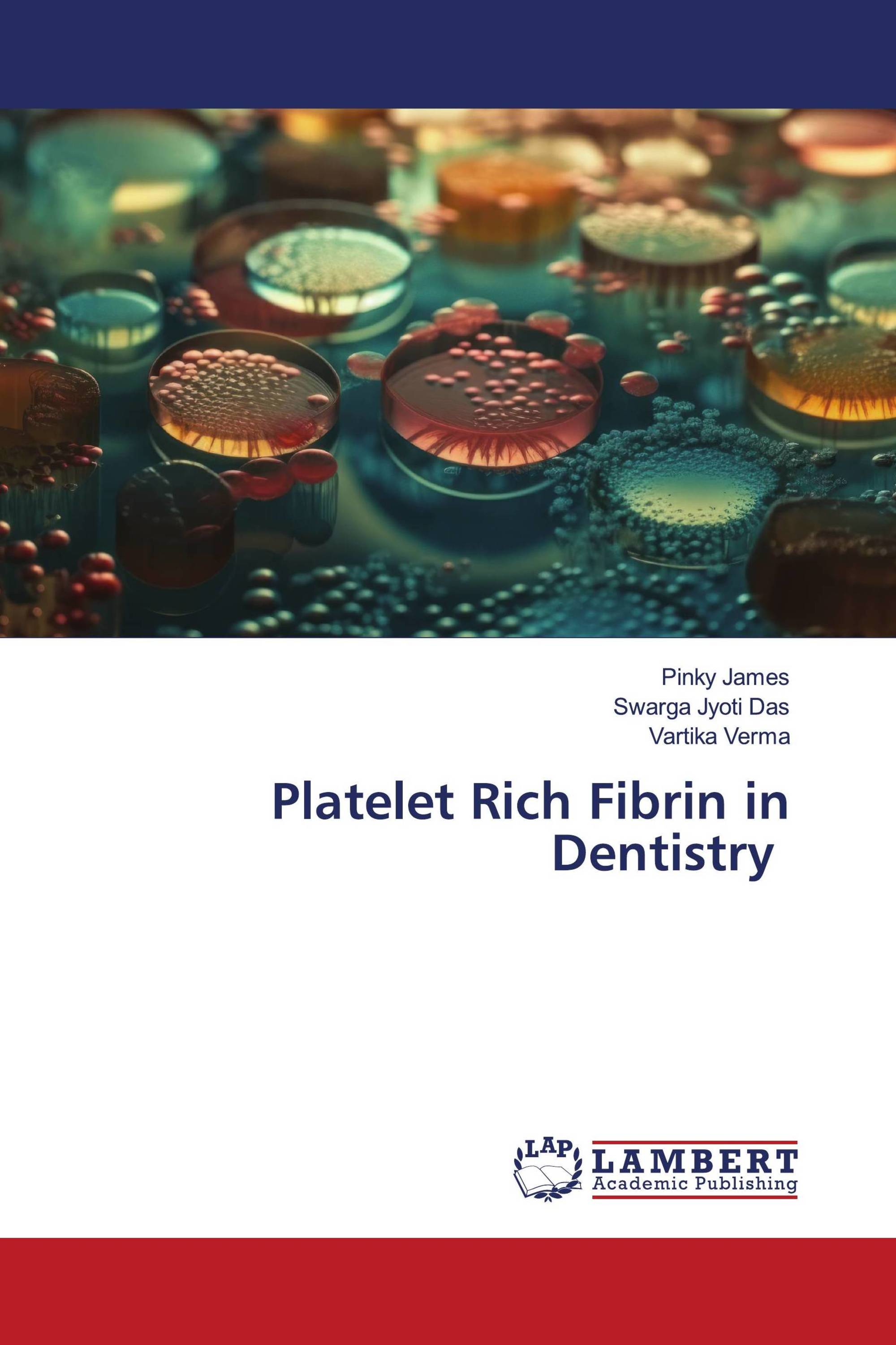Platelet Rich Fibrin in Dentistry / 978-620-7-65418-5 / 9786207654185 ...