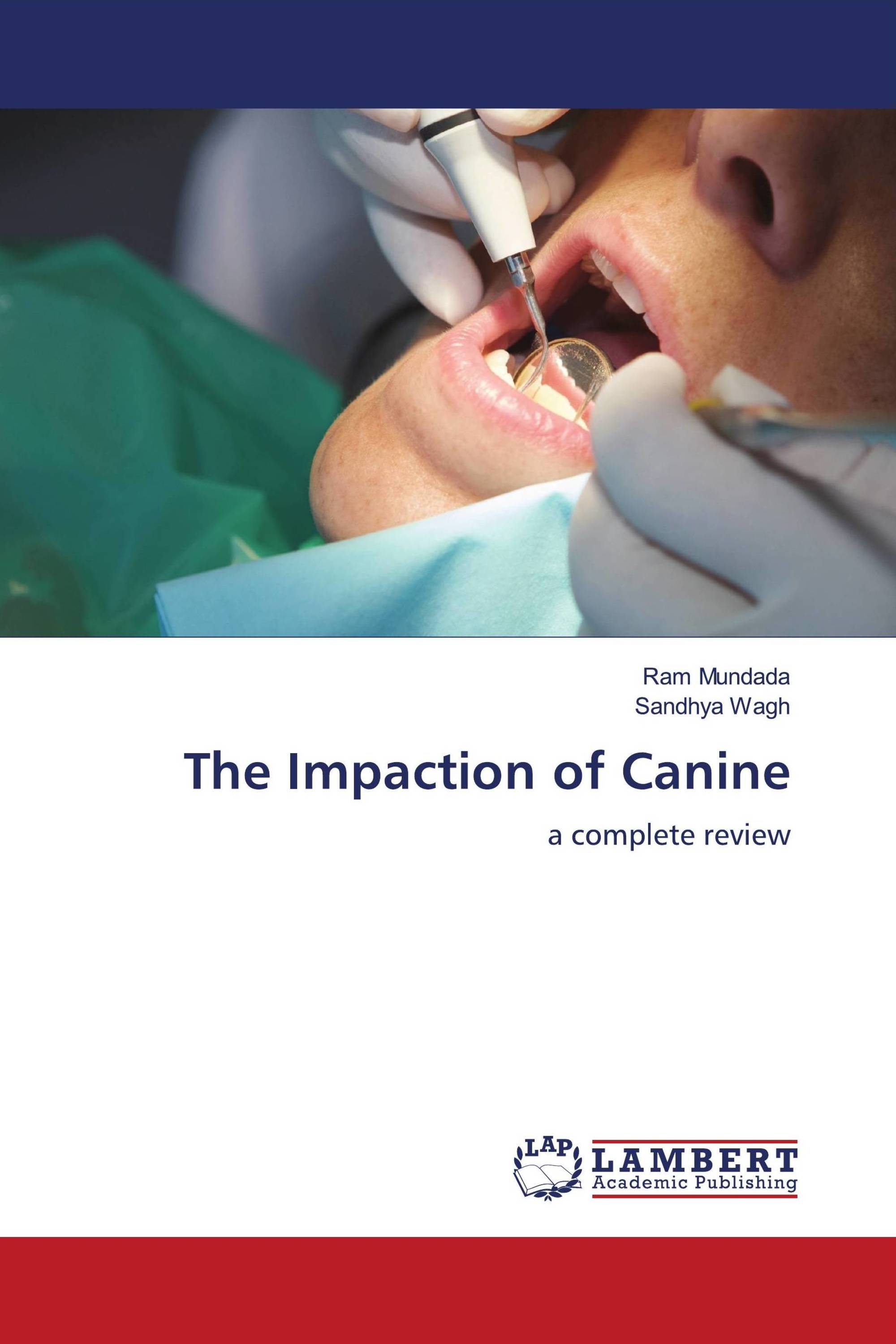 The Impaction of Canine / 978-620-7-99598-1 / 9786207995981 / 6207995988