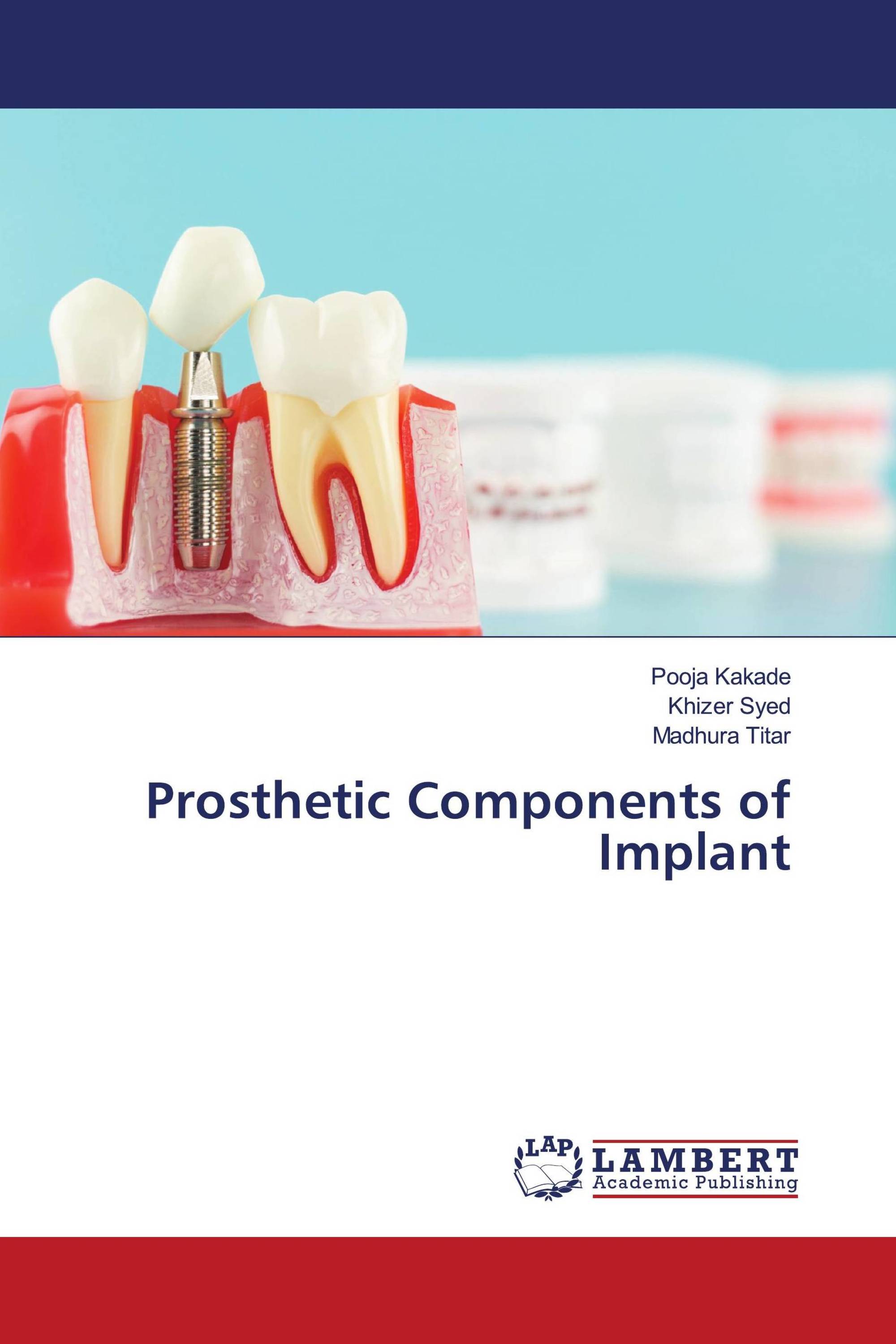 Prosthetic Components of Implant / 978-620-8-41542-6 / 9786208415426 ...