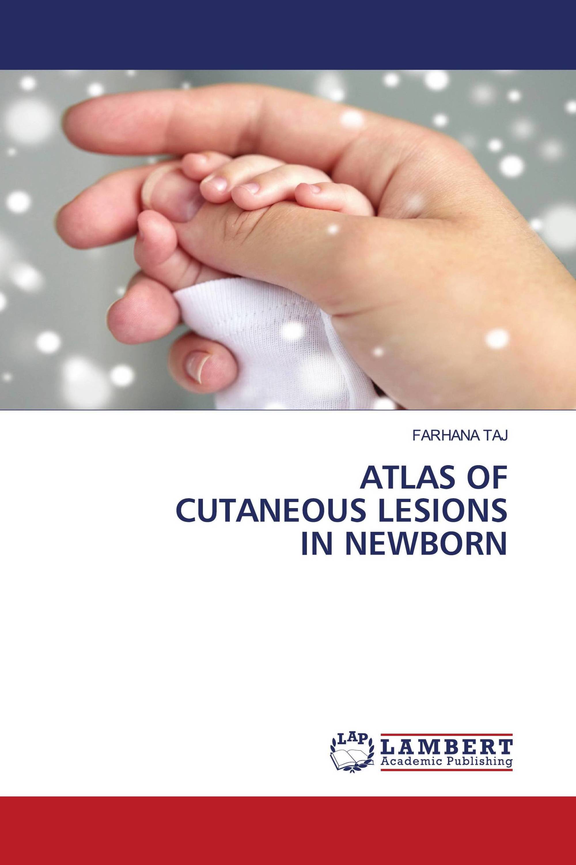 ATLAS OF CUTANEOUS LESIONS IN NEWBORN / 978-620-8-42285-1 ...