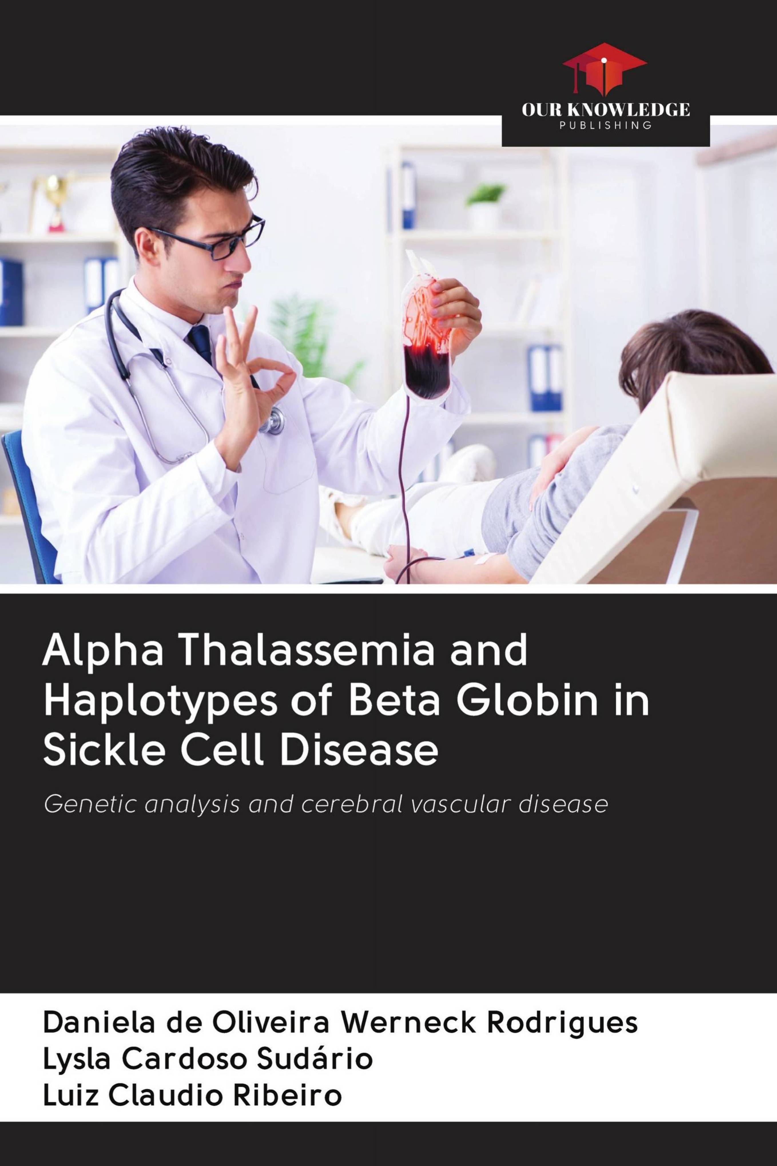Buy Alpha Thalassemia and Haplotypes of Beta Globin in Sickle Cell ...