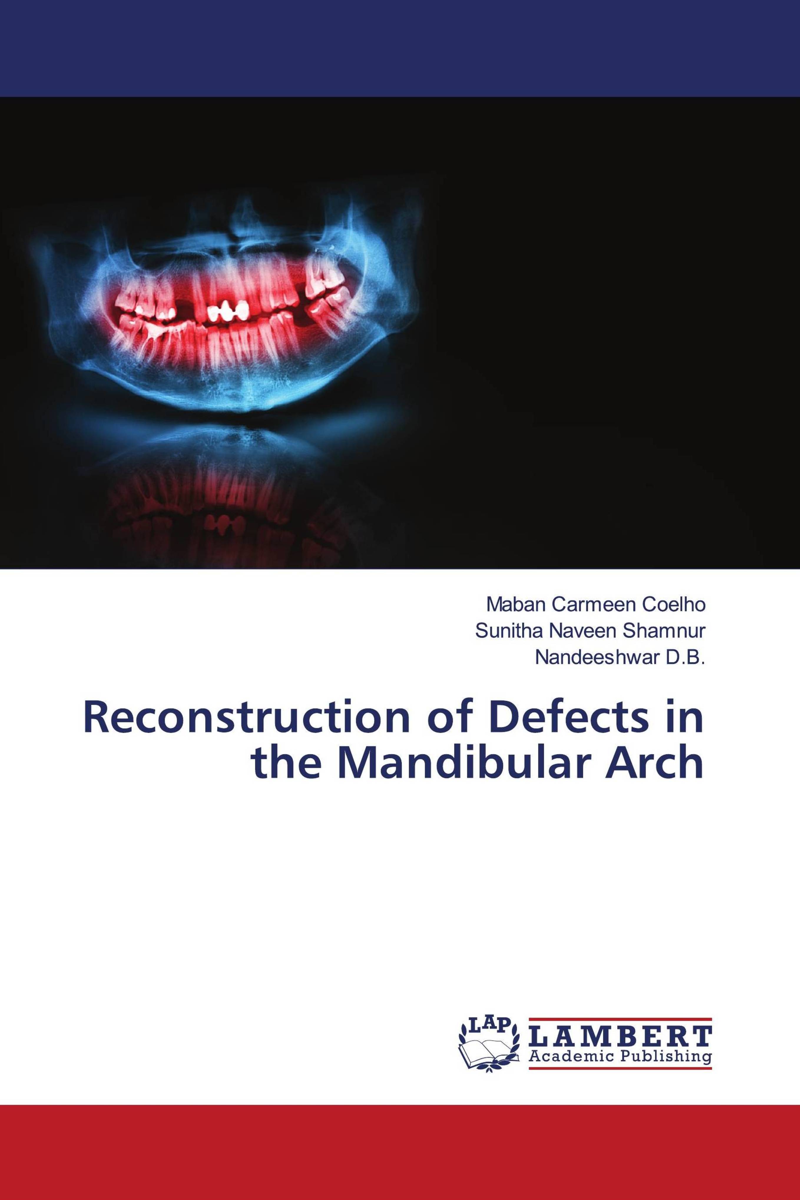 Buy Reconstruction of Defects in the Mandibular Arch Book Online at ...