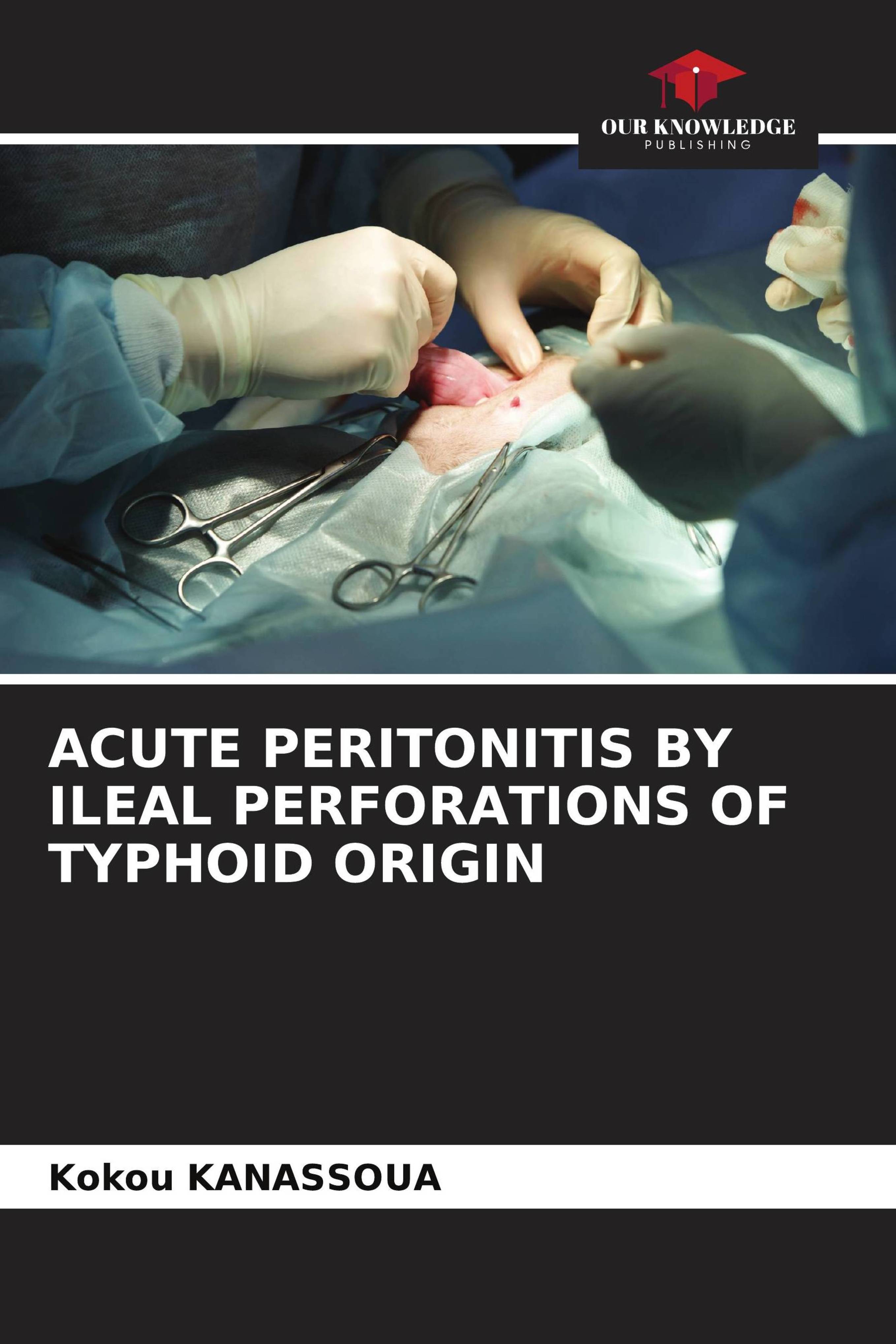 Buy ACUTE PERITONITIS BY ILEAL PERFORATIONS OF TYPHOID ORIGIN Book ...