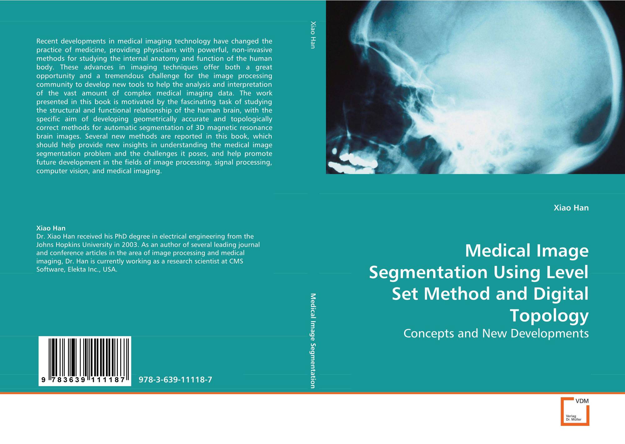 Medical Image Segmentation Using Level Set Method Anddigital Topology 978 3 639 11118 7