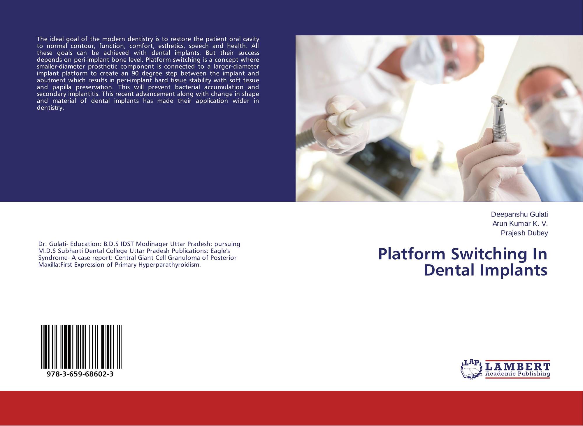 Platform Switching In Dental Implants, 978-3-659-68602-3, 3659686026 ...