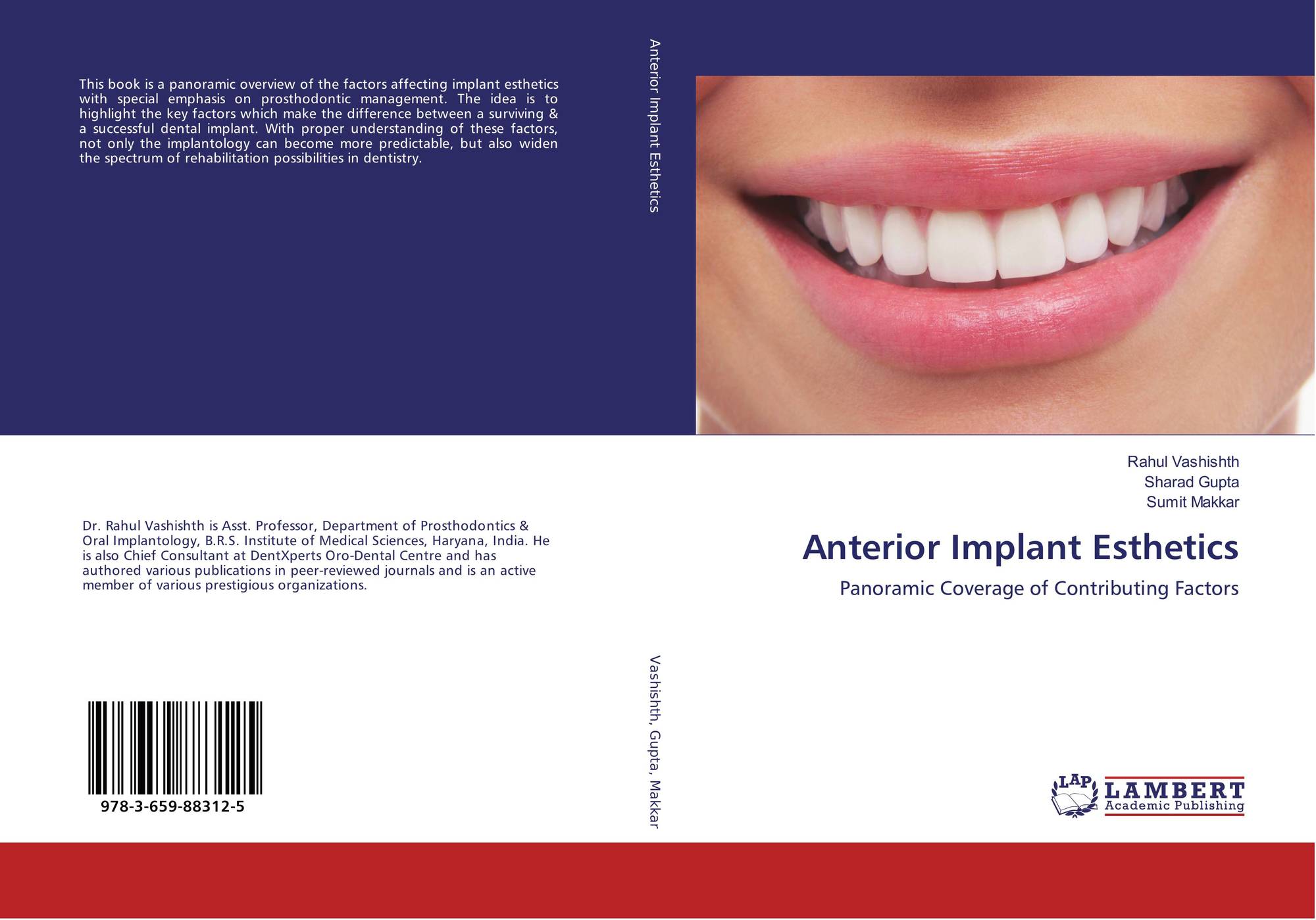 Anterior Implant Esthetics, 978-3-659-88312-5, 3659883123 ...