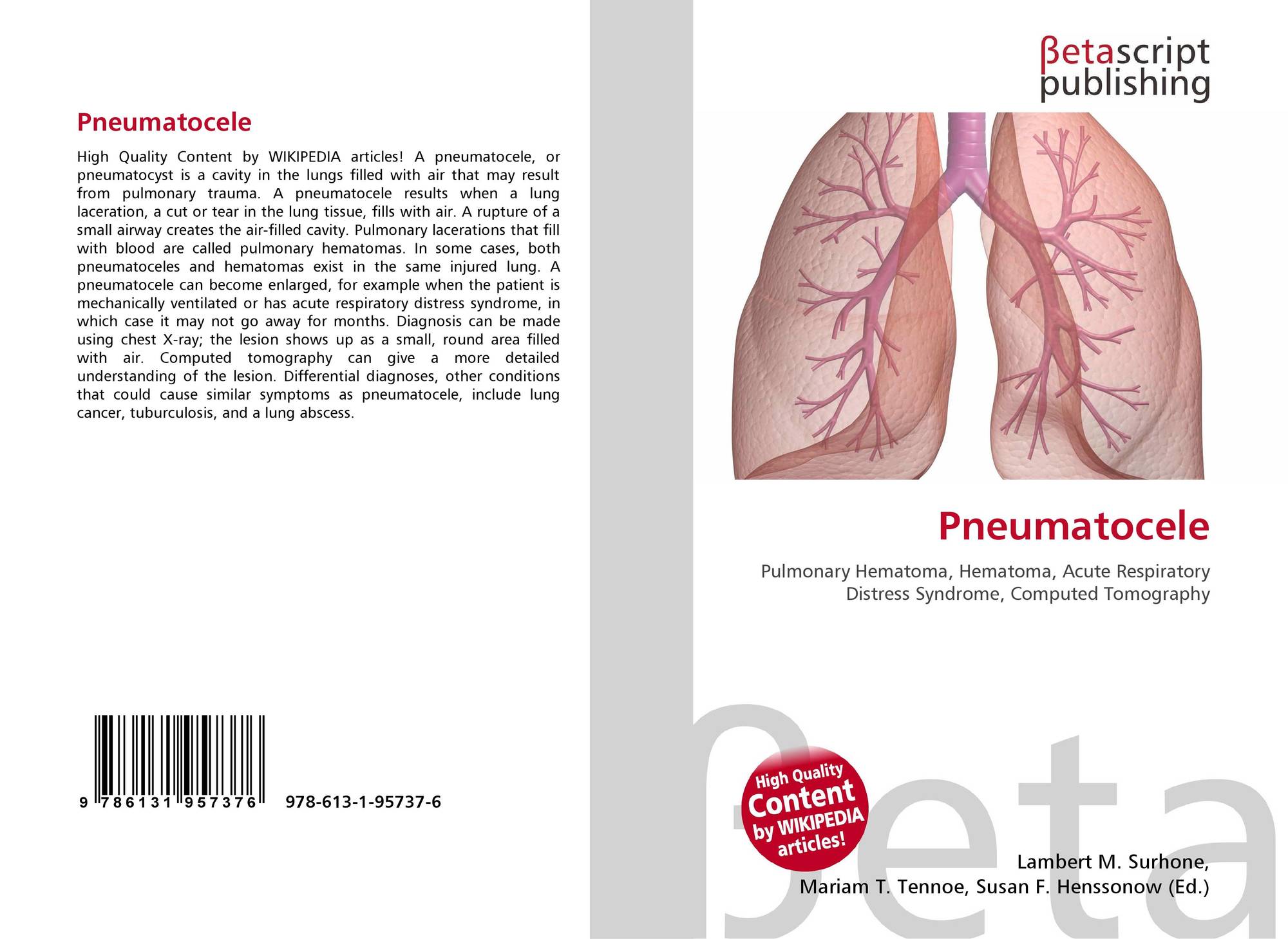 Search results for "pneumatocele"