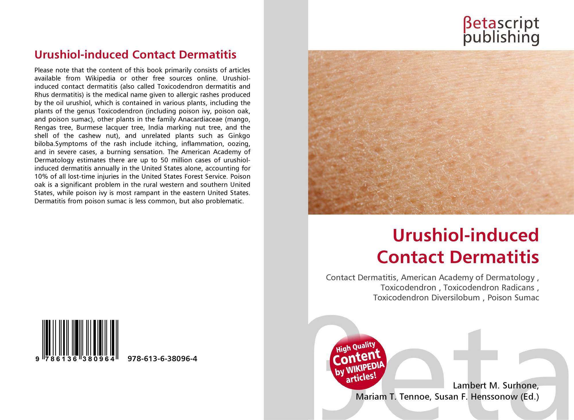 Urushiol Induced Contact Dermatitis 978 613 6 38096 4 613638096x 9786136380964