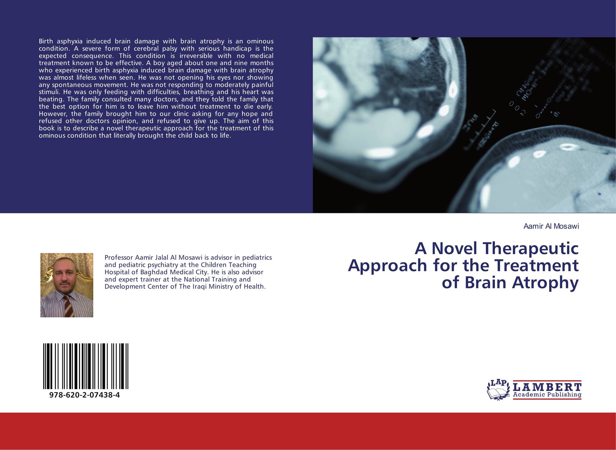 A Novel Therapeutic Approach for the Treatment of Brain Atrophy, 978 ...